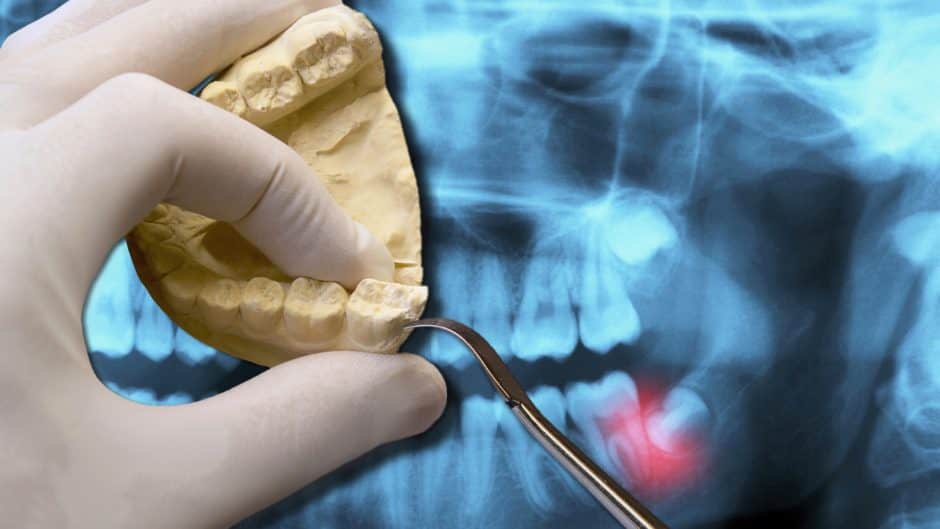 RTG Diagnostika | Pearl dental